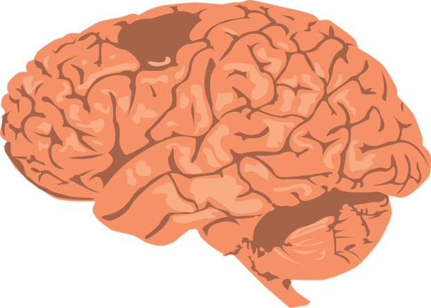 Julio Fraomeni implementó el Código Stroke en el Sanatorio Trinidad ...